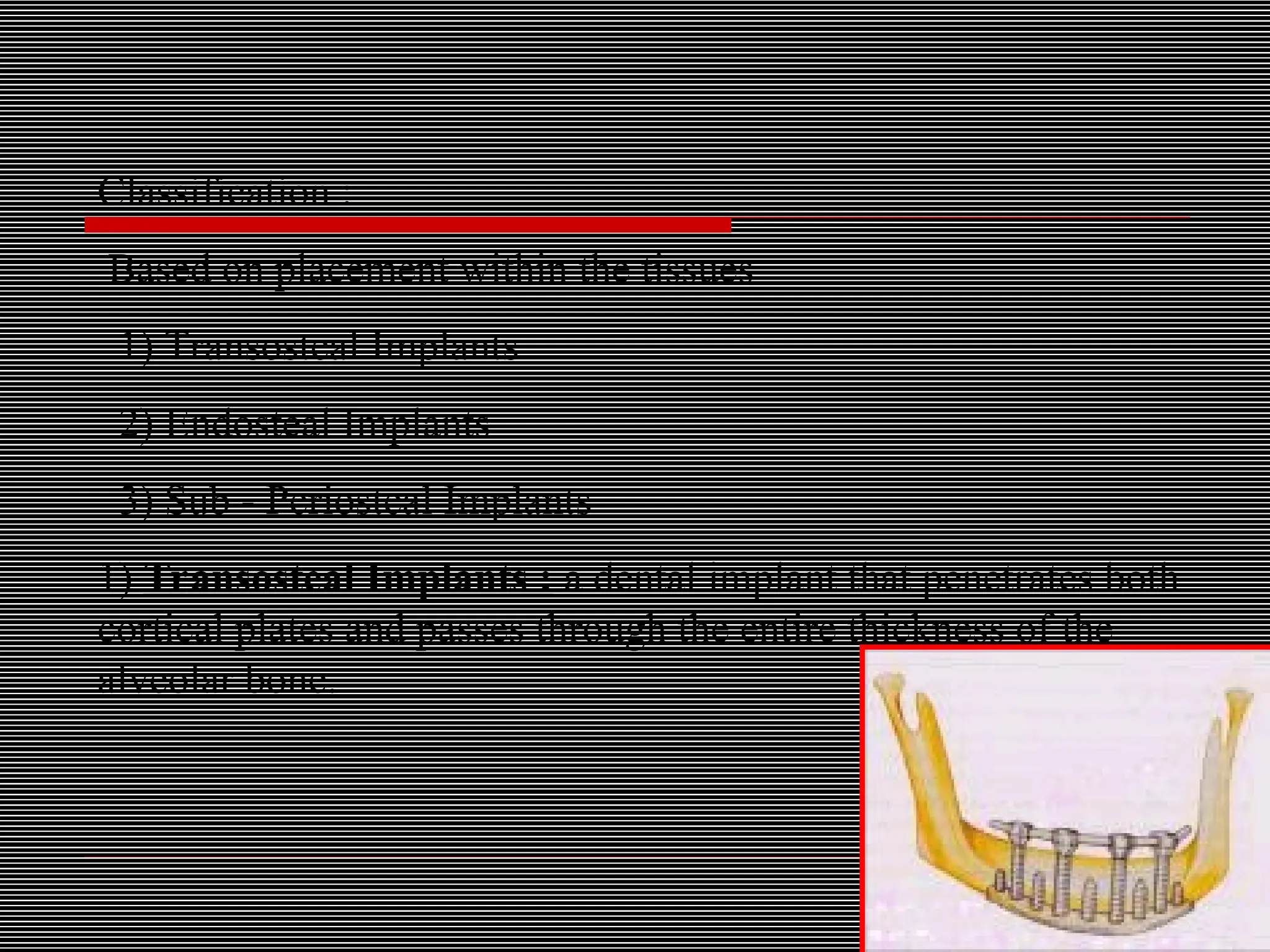 seminar 10 - DENTAL IMPLANTS- SURGICAL ASPECT, IMPLANT FAILURE (1).ppt