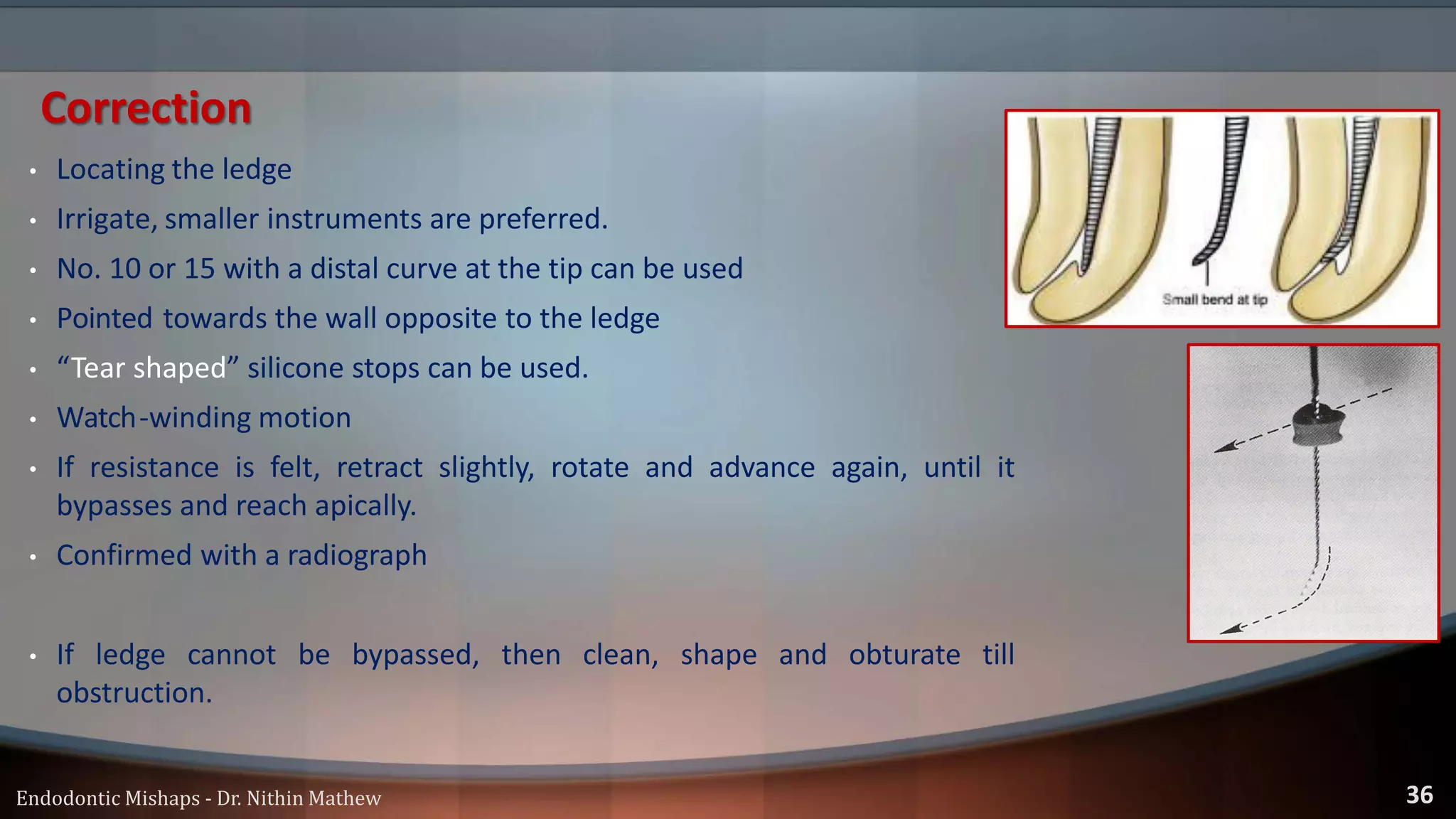 Endodontic Mishaps | PDF