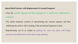 SEMINAR 10 - Horizontal root fractures.pptx