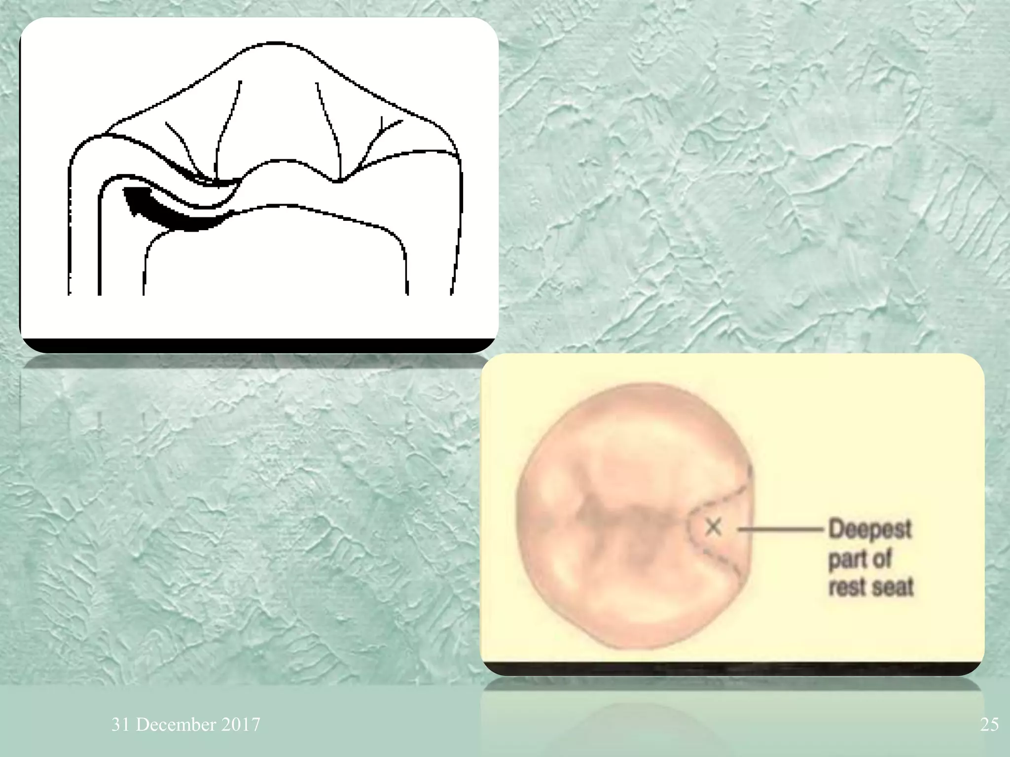 Rest and Rest seat | PPTX