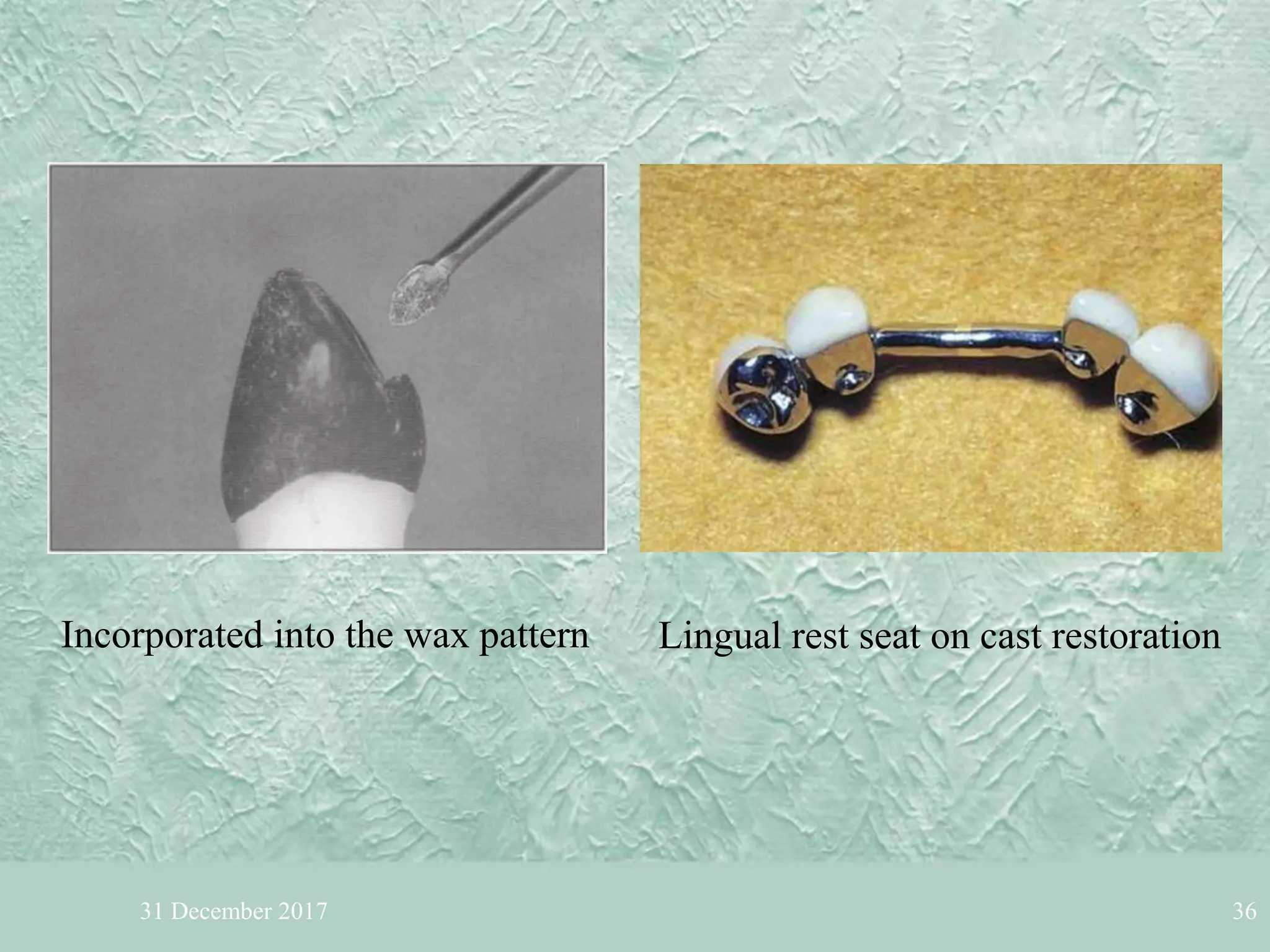 Rest and Rest seat | PPTX