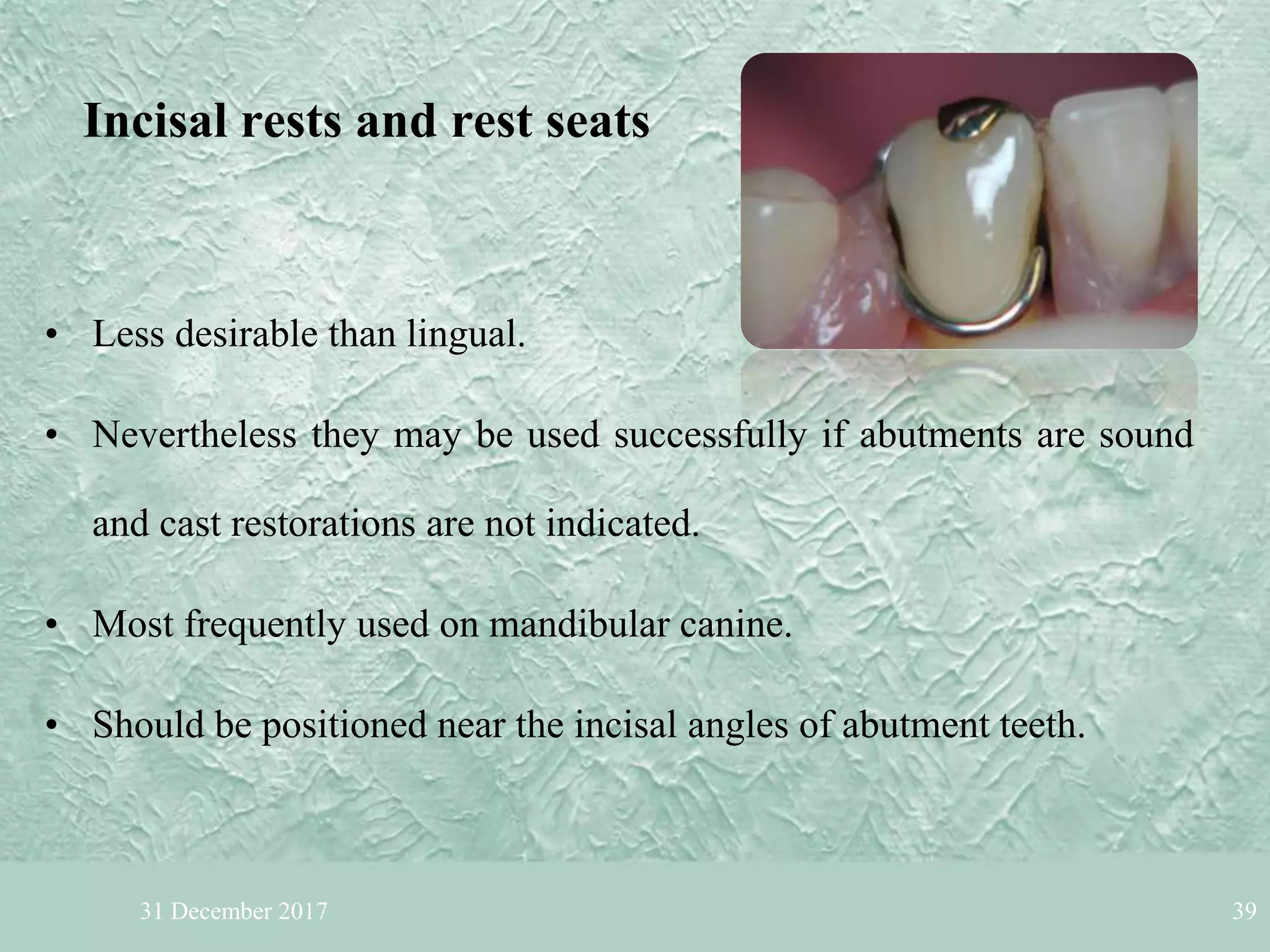 Rest and Rest seat | PPTX