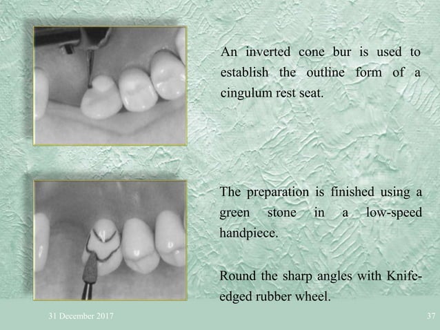 Rest and Rest seat | PPTX