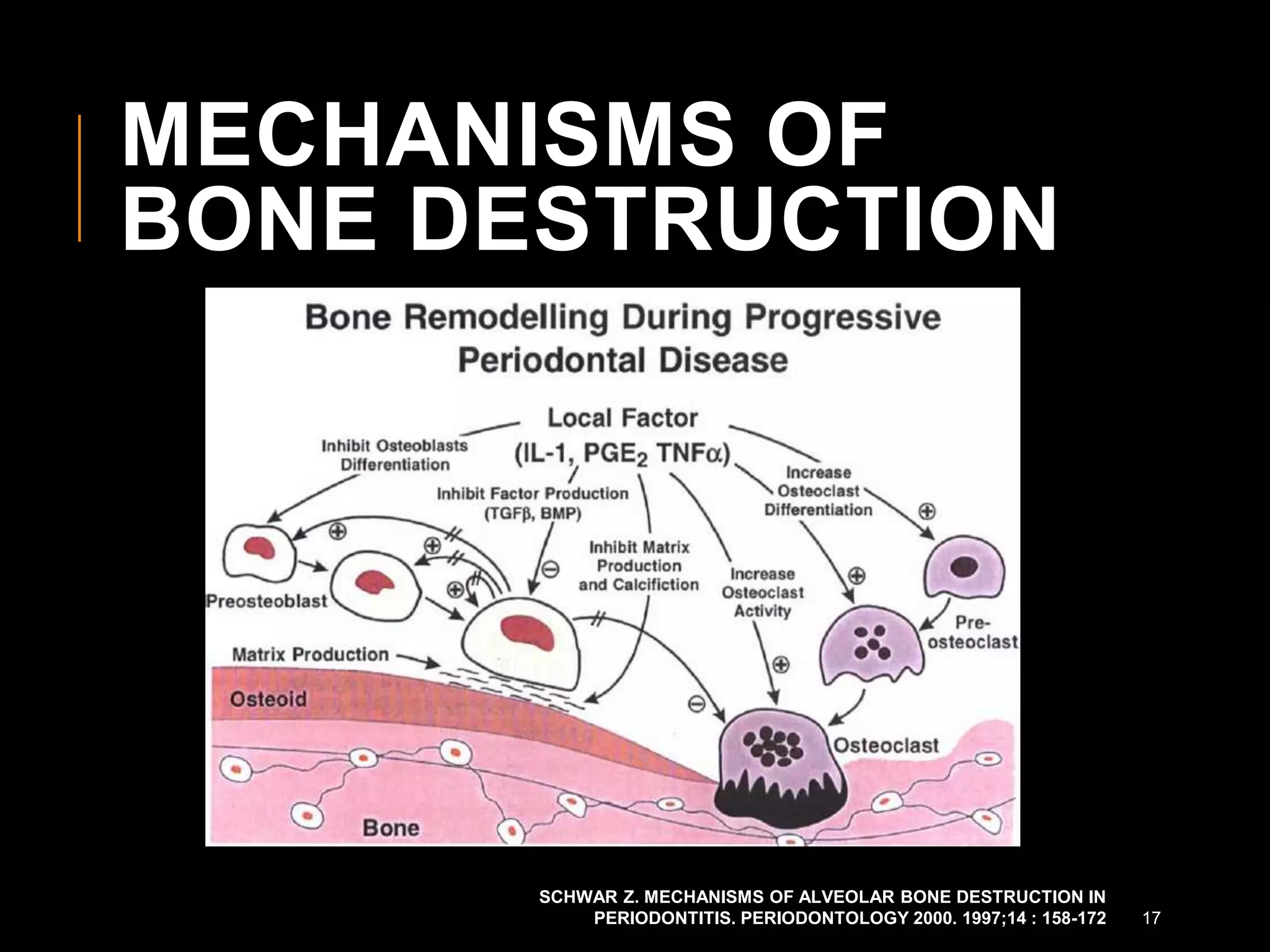 Periodontal bone defects | PPTX