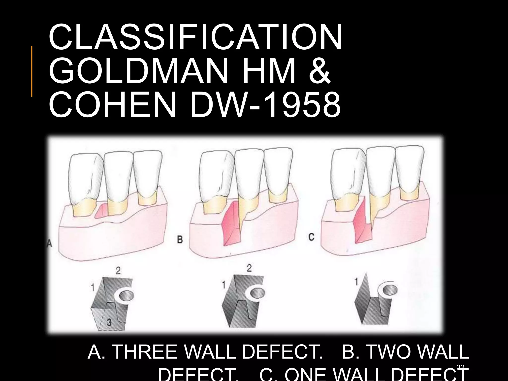 Periodontal bone defects | PPTX