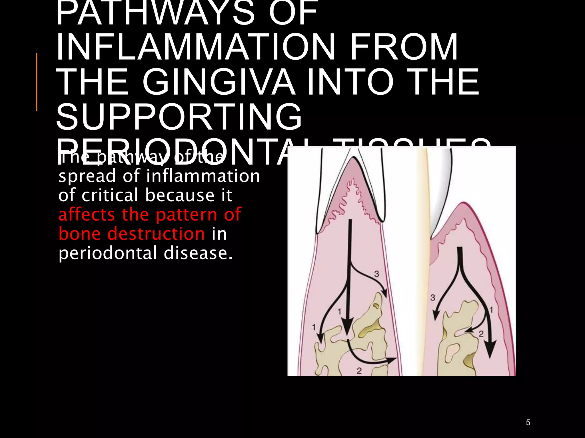 Periodontal bone defects | PPTX