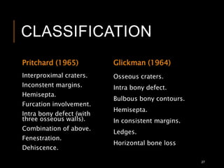 Periodontal bone defects | PPT