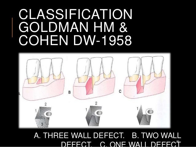 Periodontal bone defects