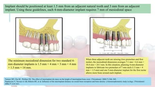 BASICS OF IMPLANTOLOGY- IMPLANT SURFACE TOPOGRAPHY COMPONENTS PARTS AND ...