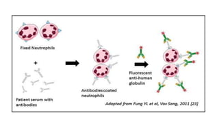 Granulocyte antigens & antibodies and their role in transfusion ...
