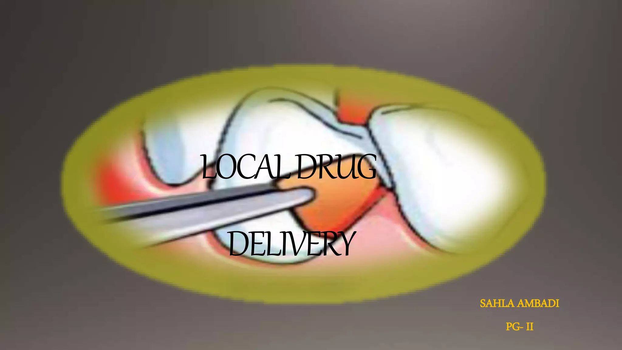 LOCAL DRUG DELIVERY IN PERIODONTICS | PPTX