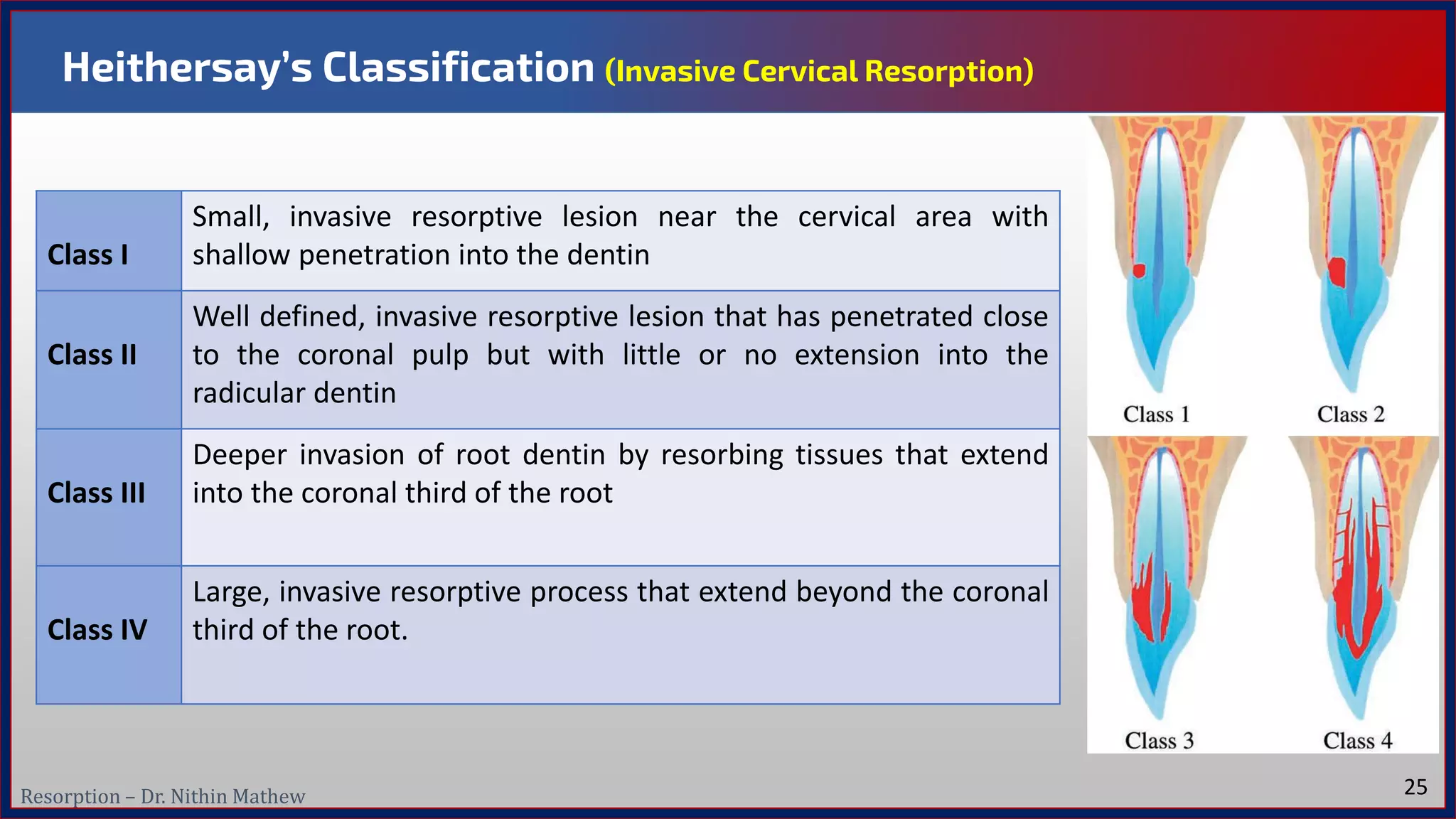 Resorption | PDF