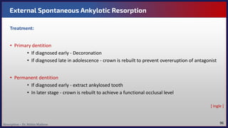Resorption | PDF