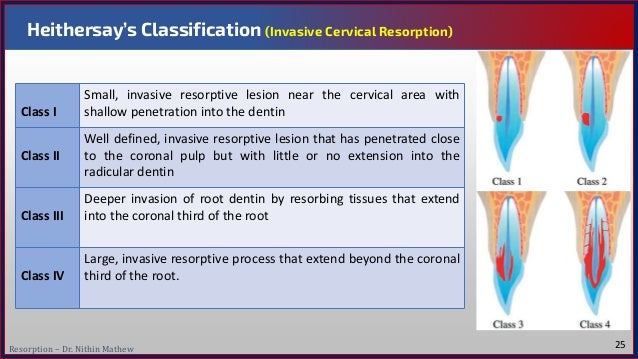 Resorption