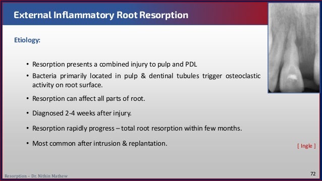 Resorption