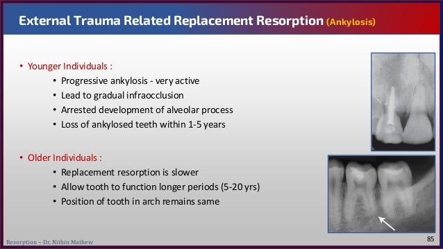 Resorption