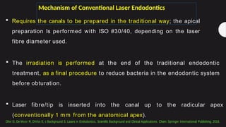 seminar 12 Lasers in endodontics.pptxZZZZZZZZZZZZZZZZZZZZZZZZZZZ | PPTX