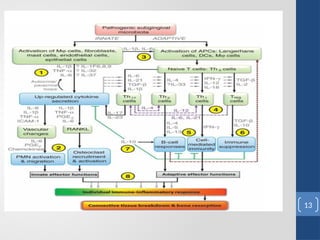 Different Models of pathogenesis in Periodontics | PPTX