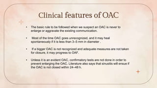 SEMINAR 13 - OAC AND OAF - introduction , surgical anatomy of maxillary ...