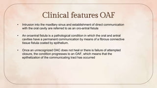 SEMINAR 13 - OAC AND OAF - introduction , surgical anatomy of maxillary ...