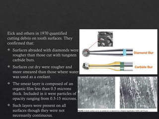 smear layer in the root canal system.pptx