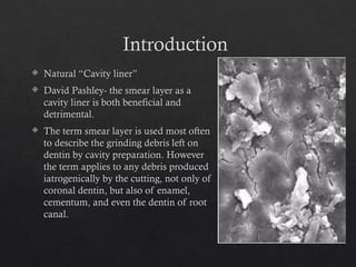 smear layer in the root canal system.pptx
