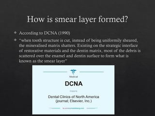 smear layer in the root canal system.pptx