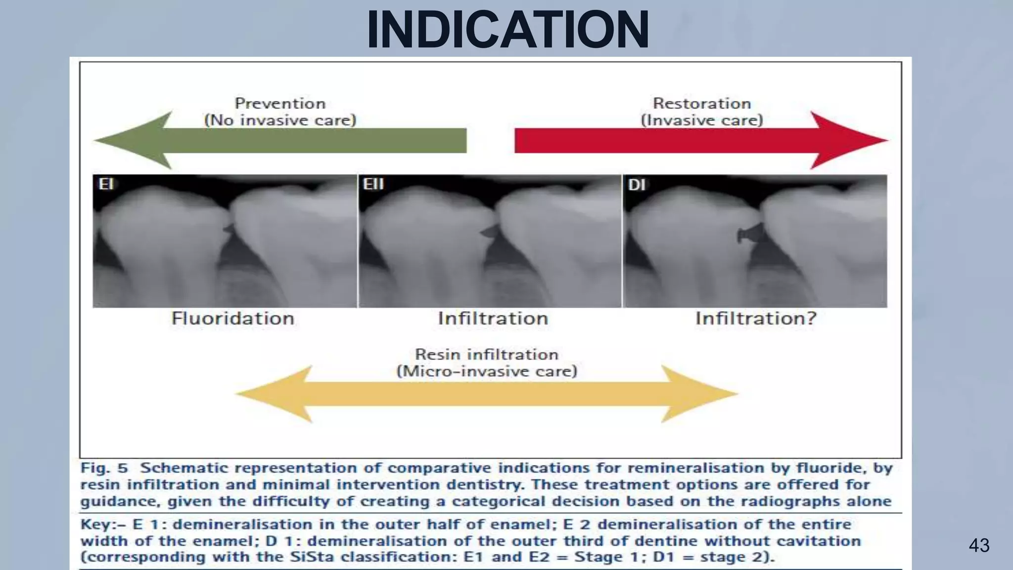 MINIMAL INTERVENTION DENTISTRY | PPTX