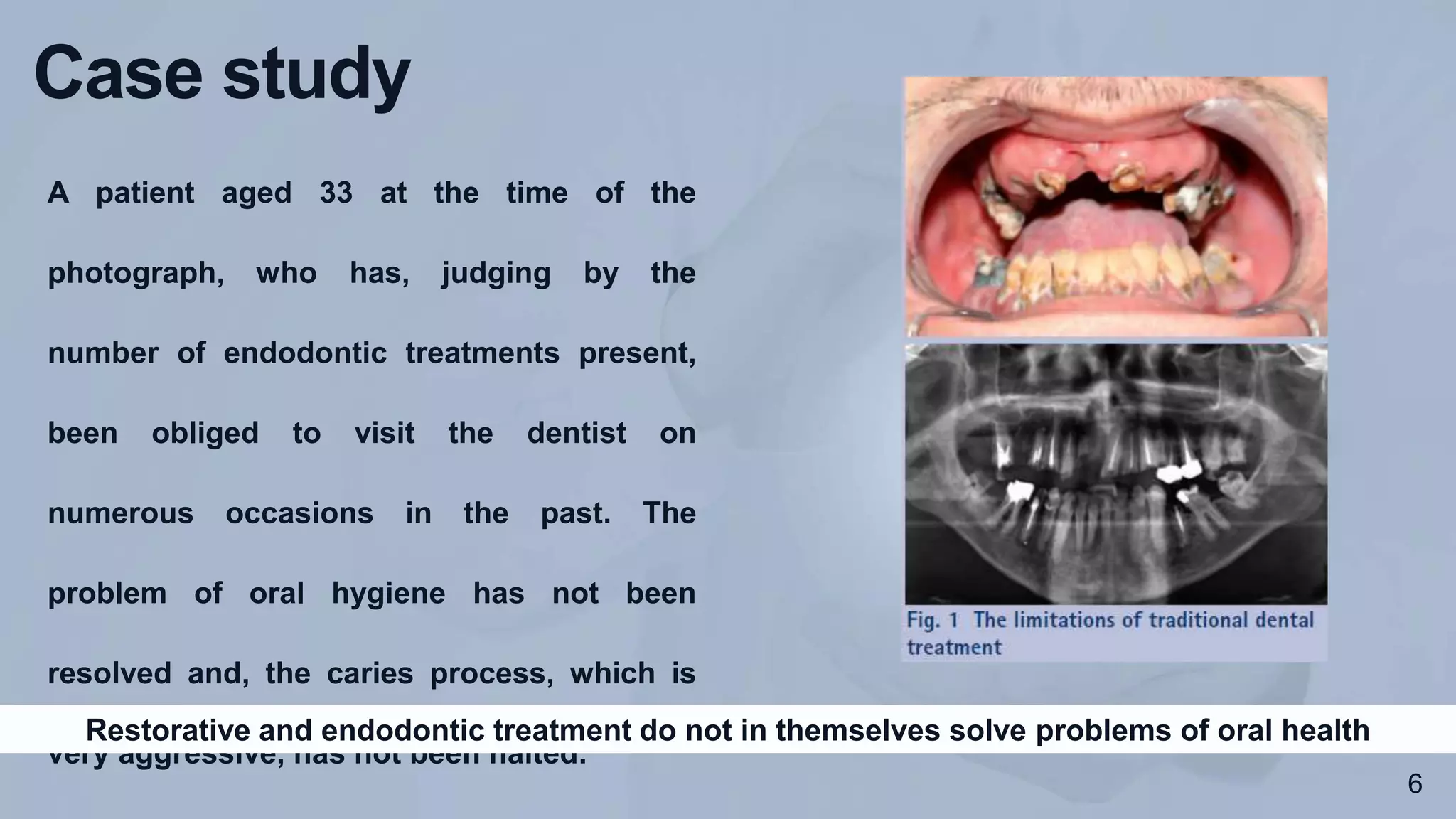 MINIMAL INTERVENTION DENTISTRY | PPTX