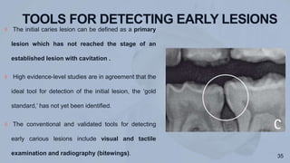 MINIMAL INTERVENTION DENTISTRY | PPTX