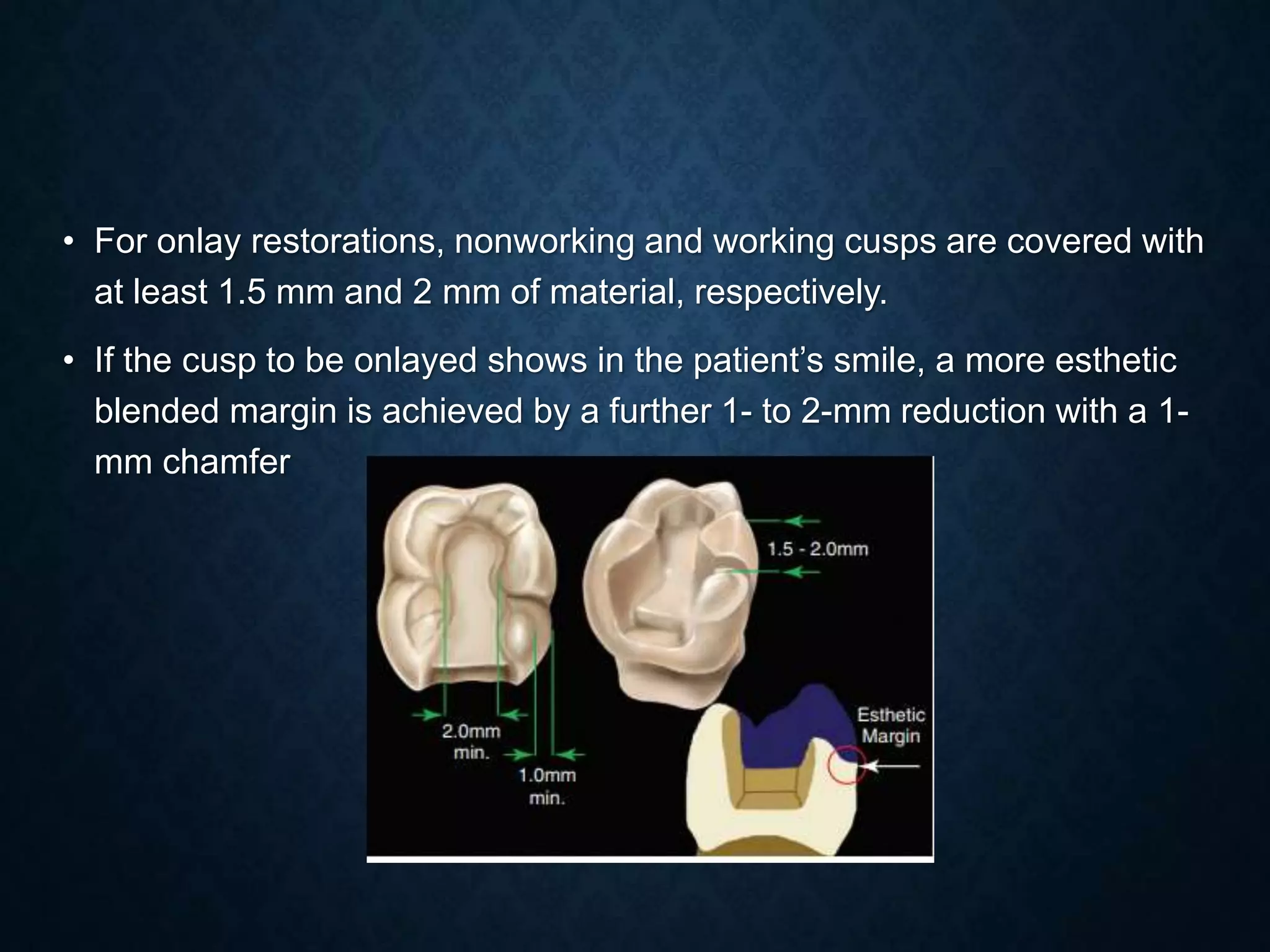 Ceramic inlays and onlays | PPTX