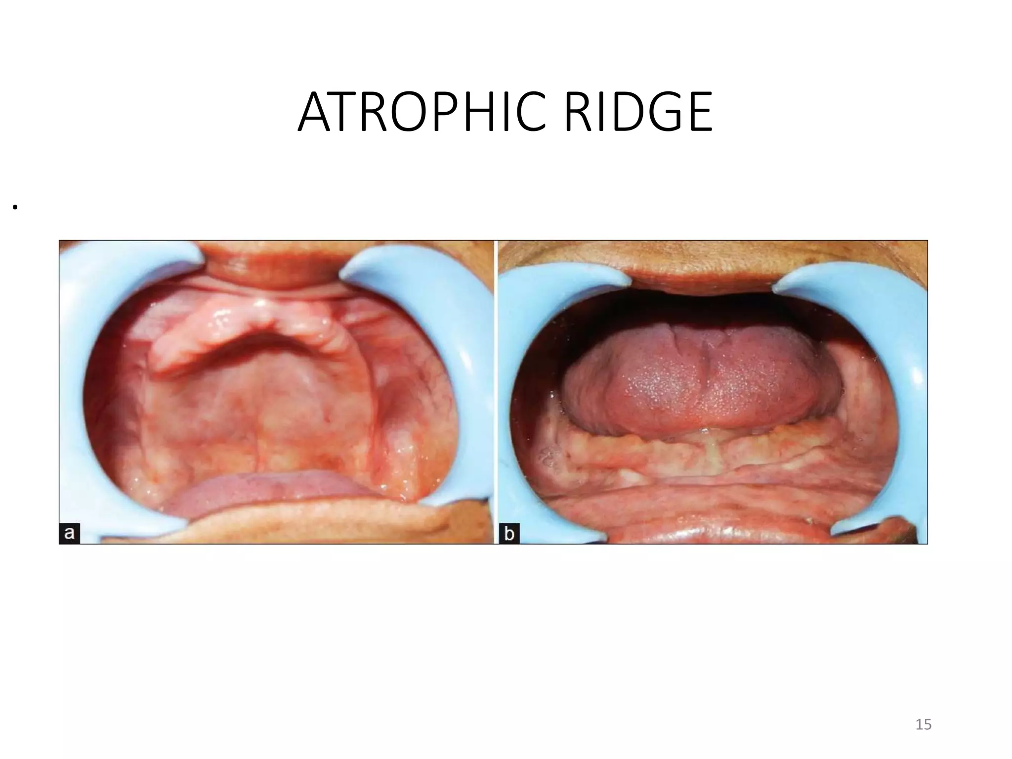 management of abused tissues | PPTX