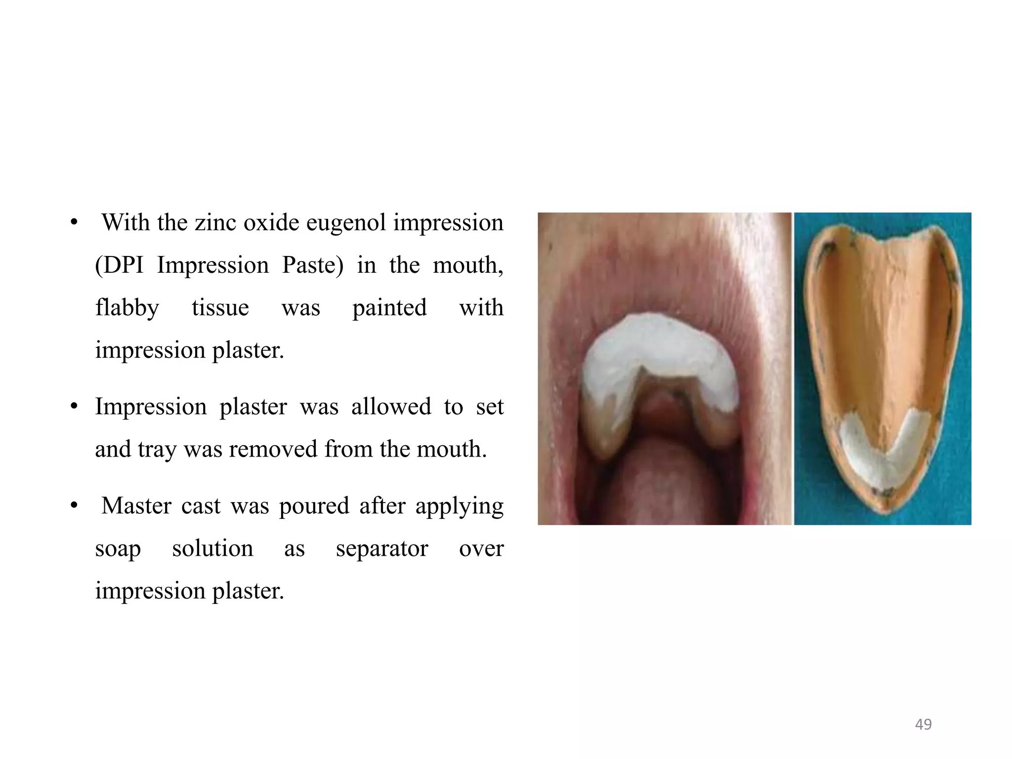 management of abused tissues | PPTX