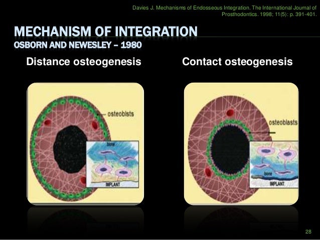 Osseointegration part 1