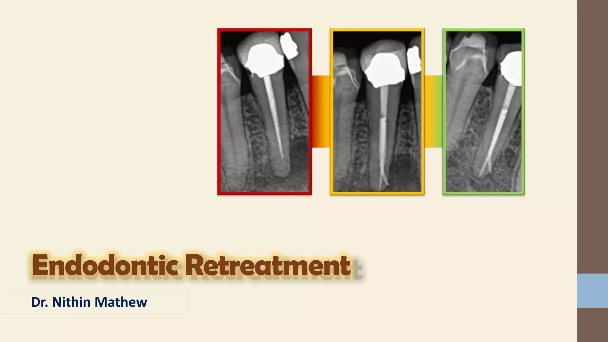 Endodontic Retreatment | PDF