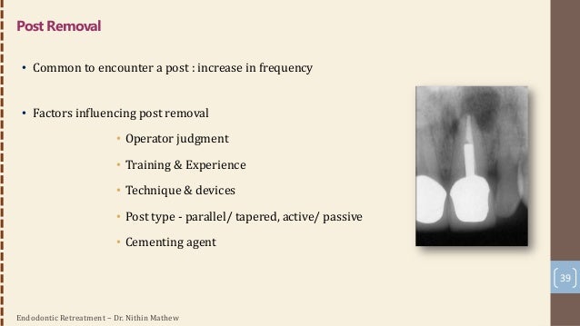 Endodontic Retreatment