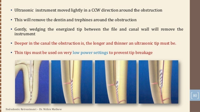 Endodontic Retreatment