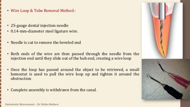 Endodontic Retreatment