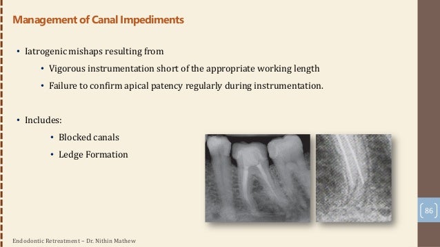 Endodontic Retreatment