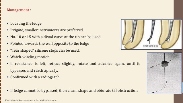 Endodontic Retreatment