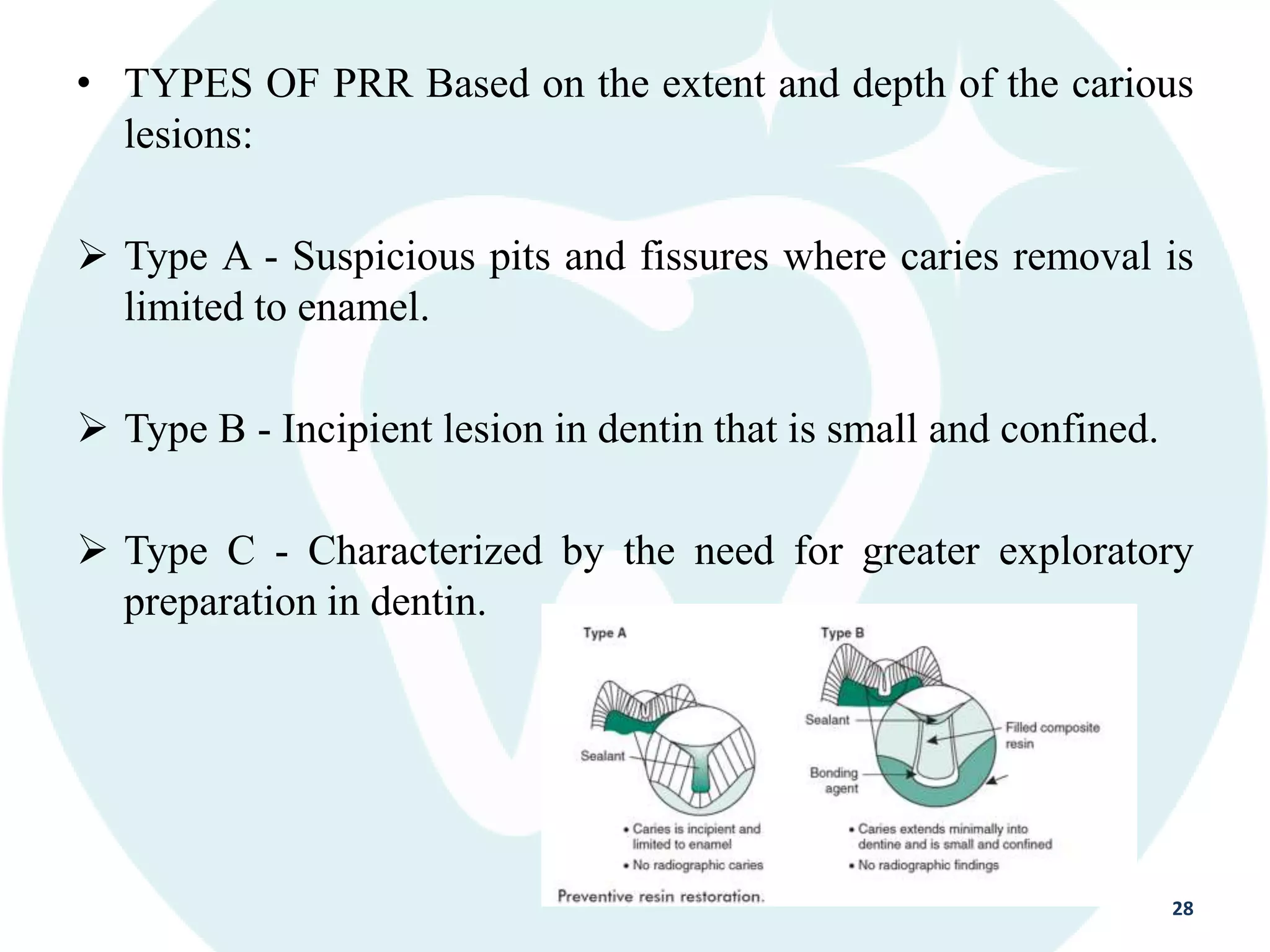 Minimal Invasive Dentistry | PPTX