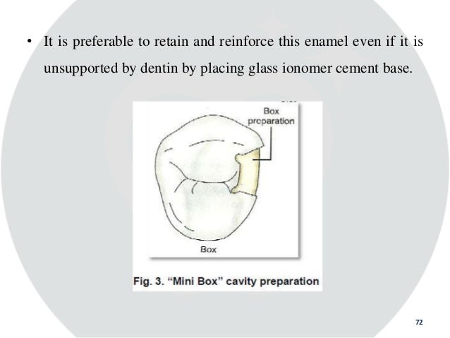 Minimal Invasive Dentistry