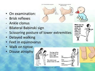 Cerebral palsy | PPT