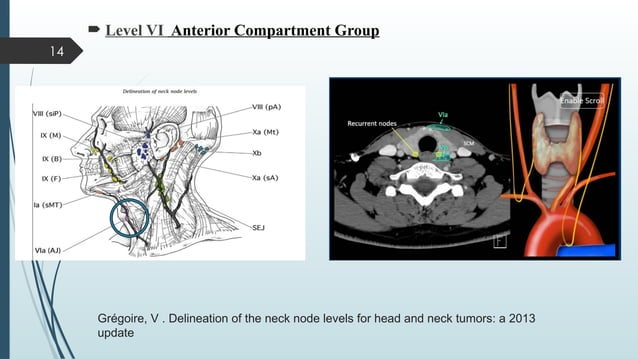 Seminar 1 Delineation of the neck node levels for head.pptx