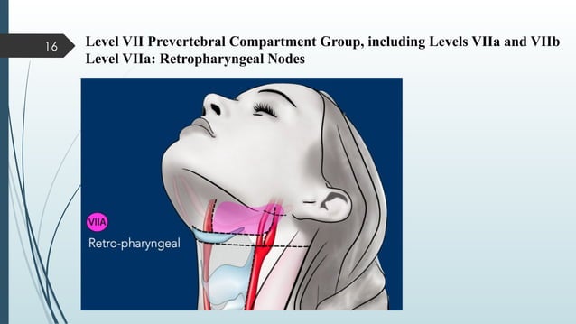 Seminar 1 Delineation of the neck node levels for head.pptx