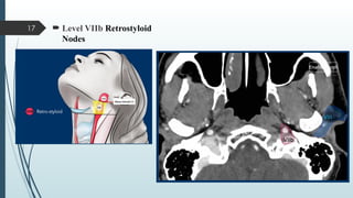 Seminar 1 Delineation of the neck node levels for head.pptx