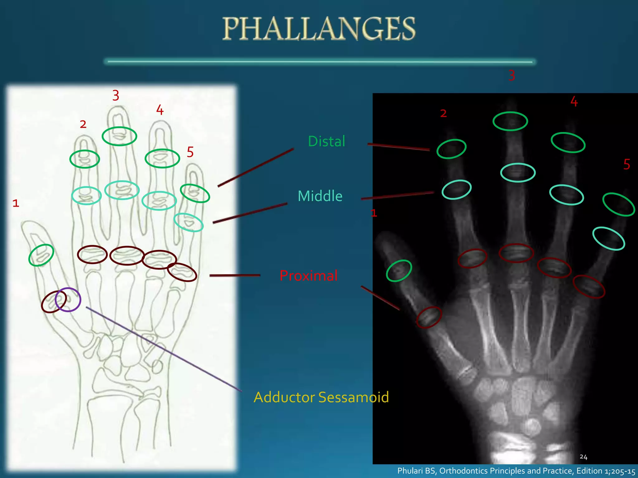 Hand Wrist Radiography | PPTX