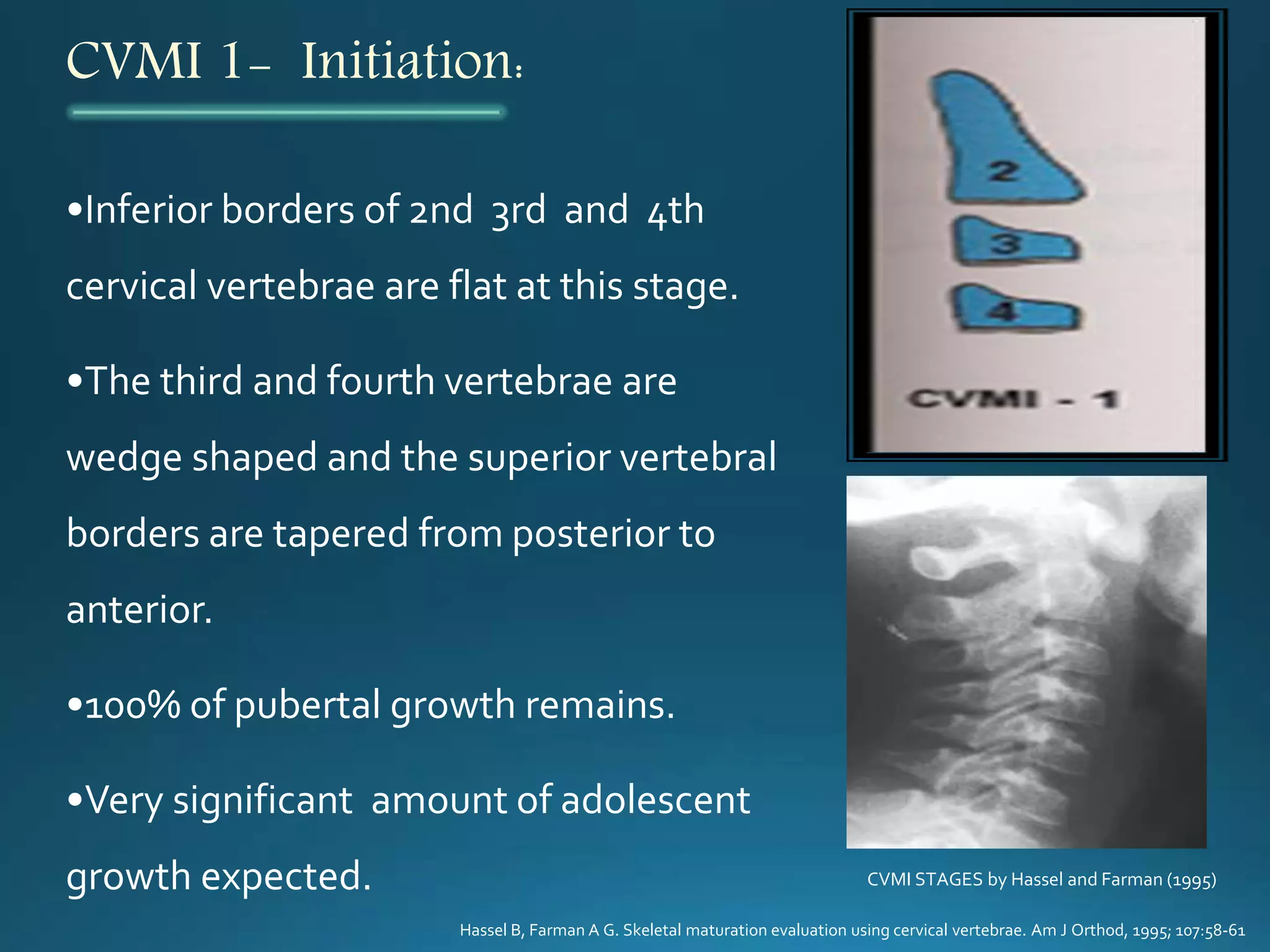 Hand Wrist Radiography | PPTX
