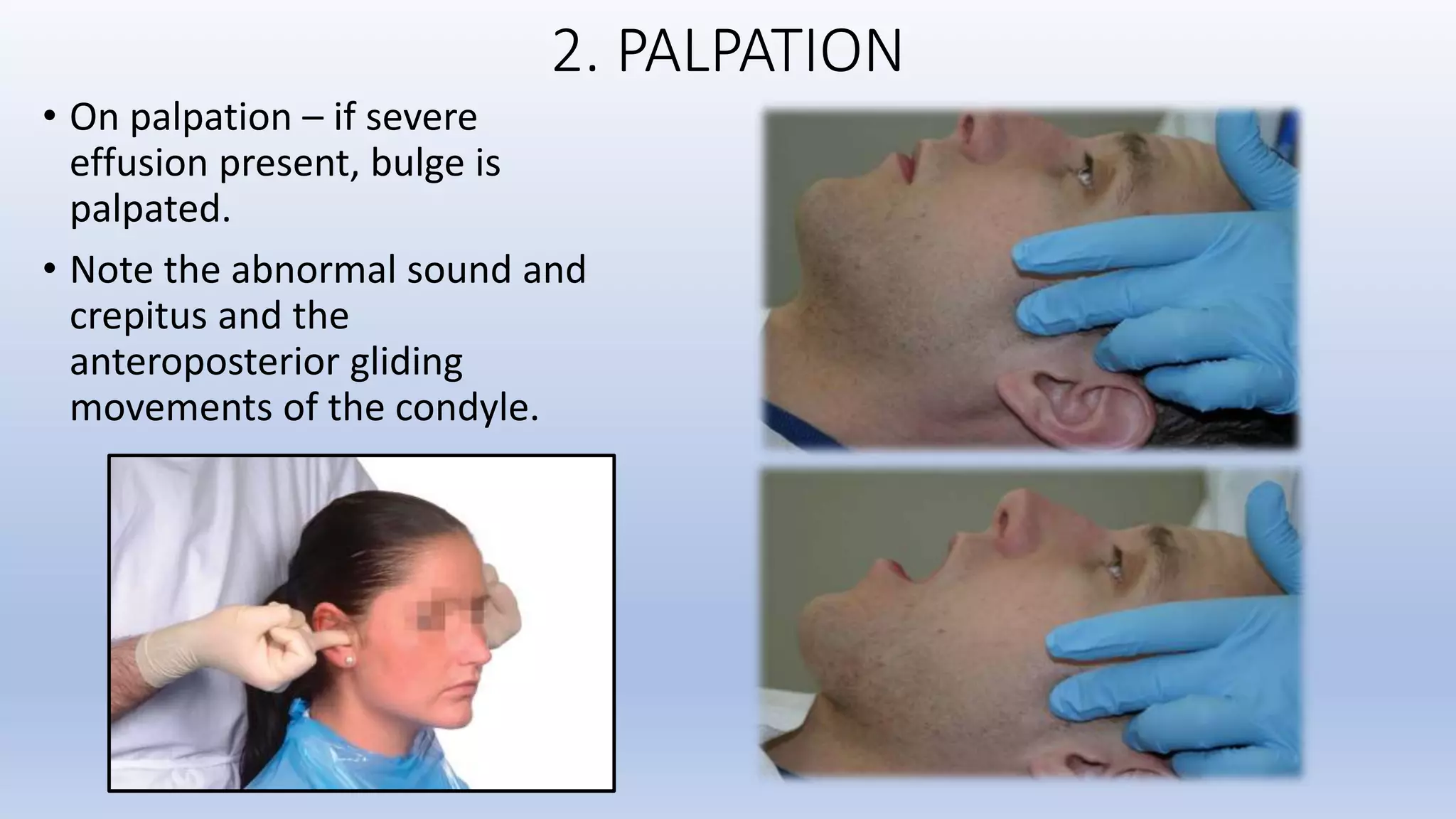 Temporomandibular Joint (Anatomy) | PPTX