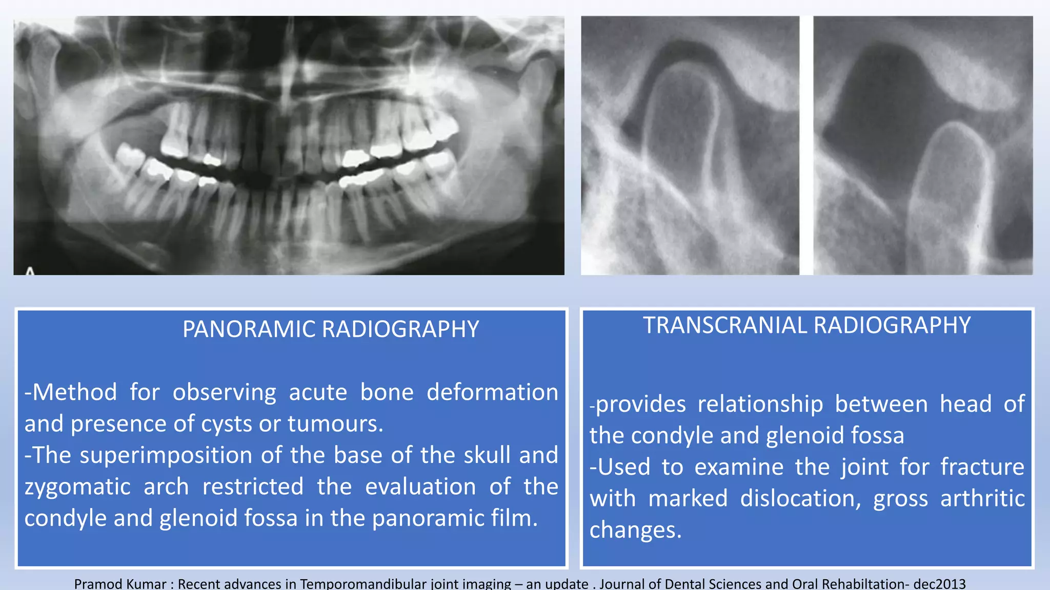 Temporomandibular Joint (Anatomy) | PPTX